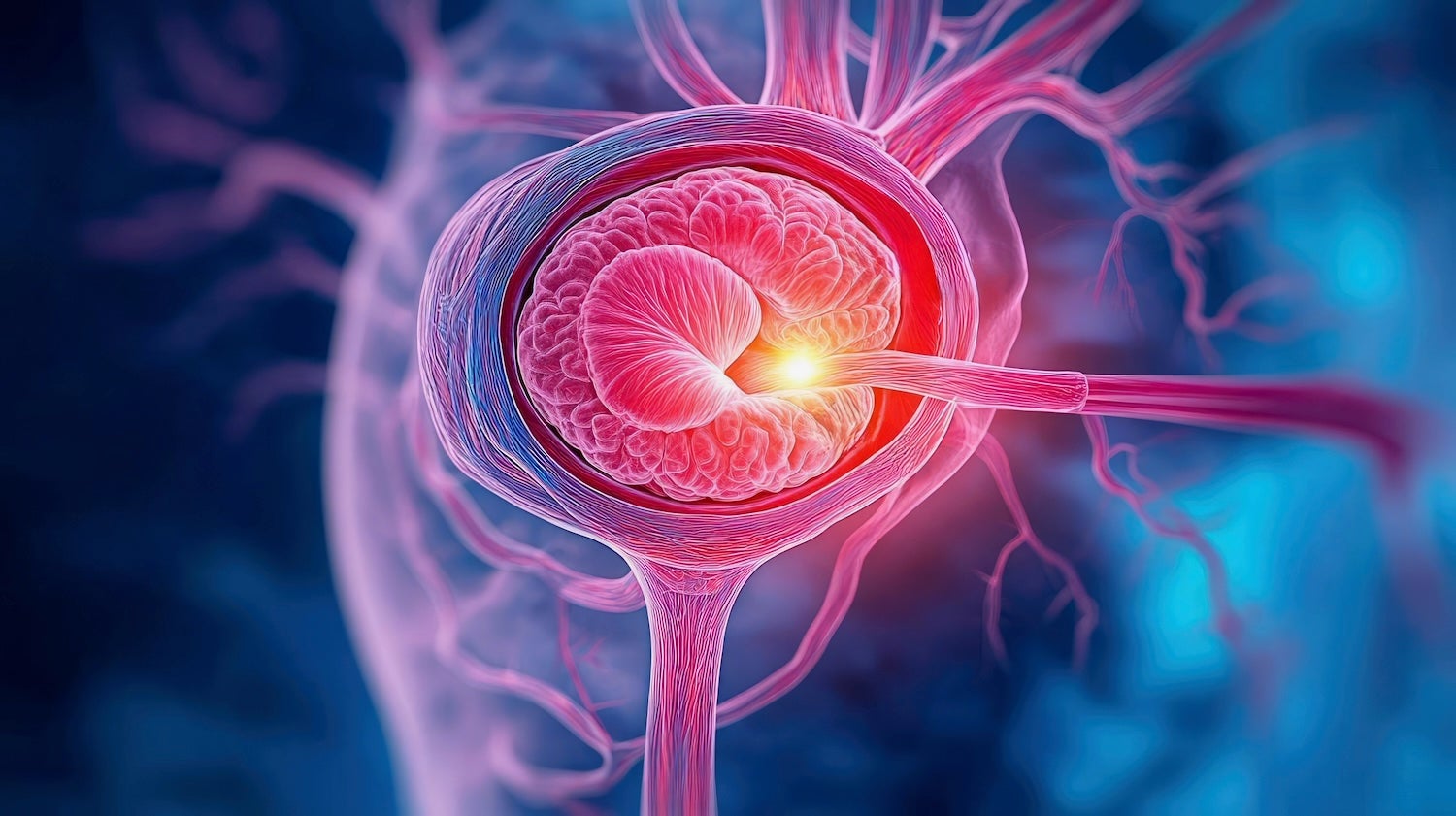 Prostate Cancer | Tulane Urology in Metairie and New Orleans, LA