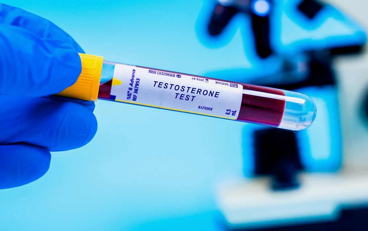 Low Testosterone | Tulane Urology in Metairie & New Orleans, LA